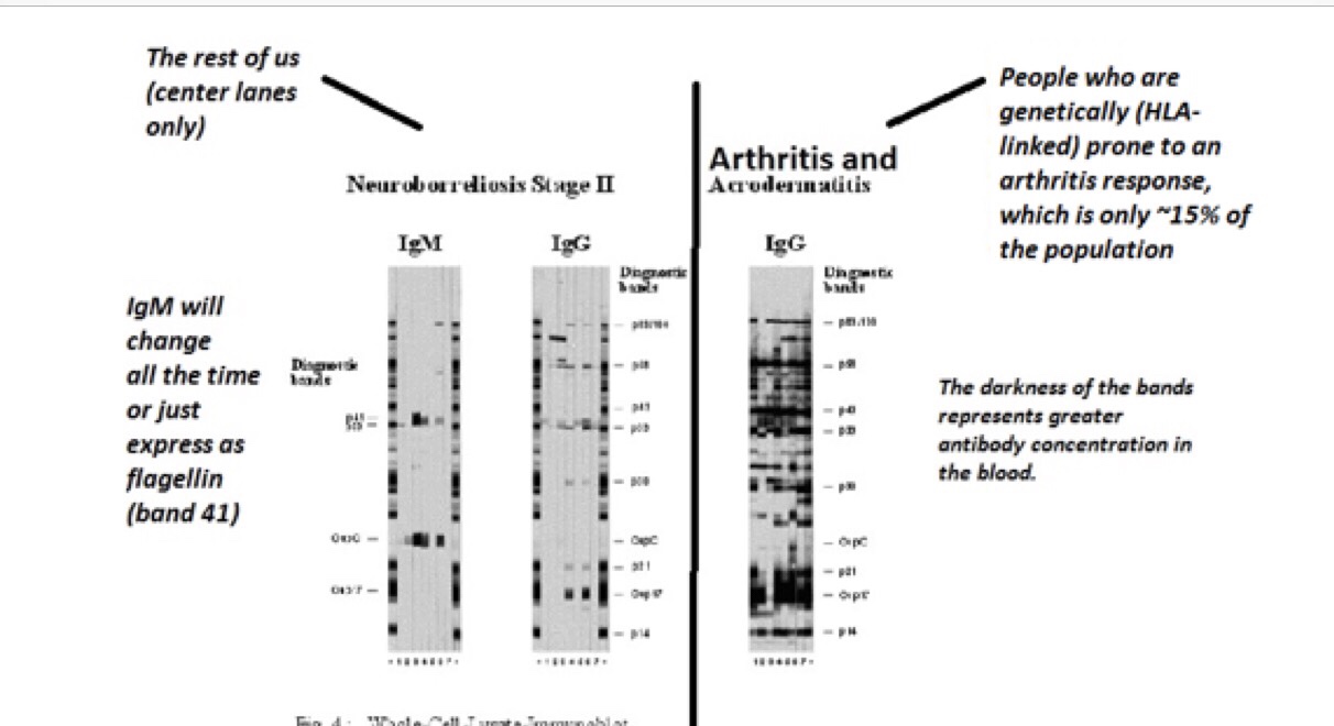 John Aucott is Not Your Friend