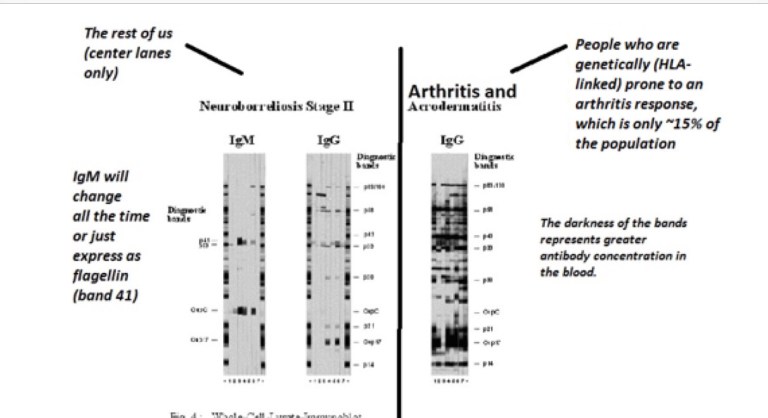 John Aucott is Not Your Friend